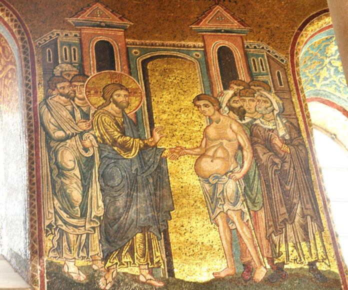 Jesus healed man of dropsy, but those watching had ‘spiritual dropsy ...