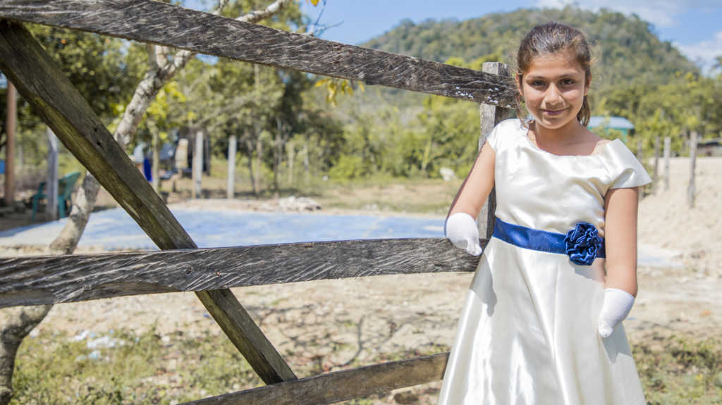 Girl born without hands glad God made her that way | God Reports