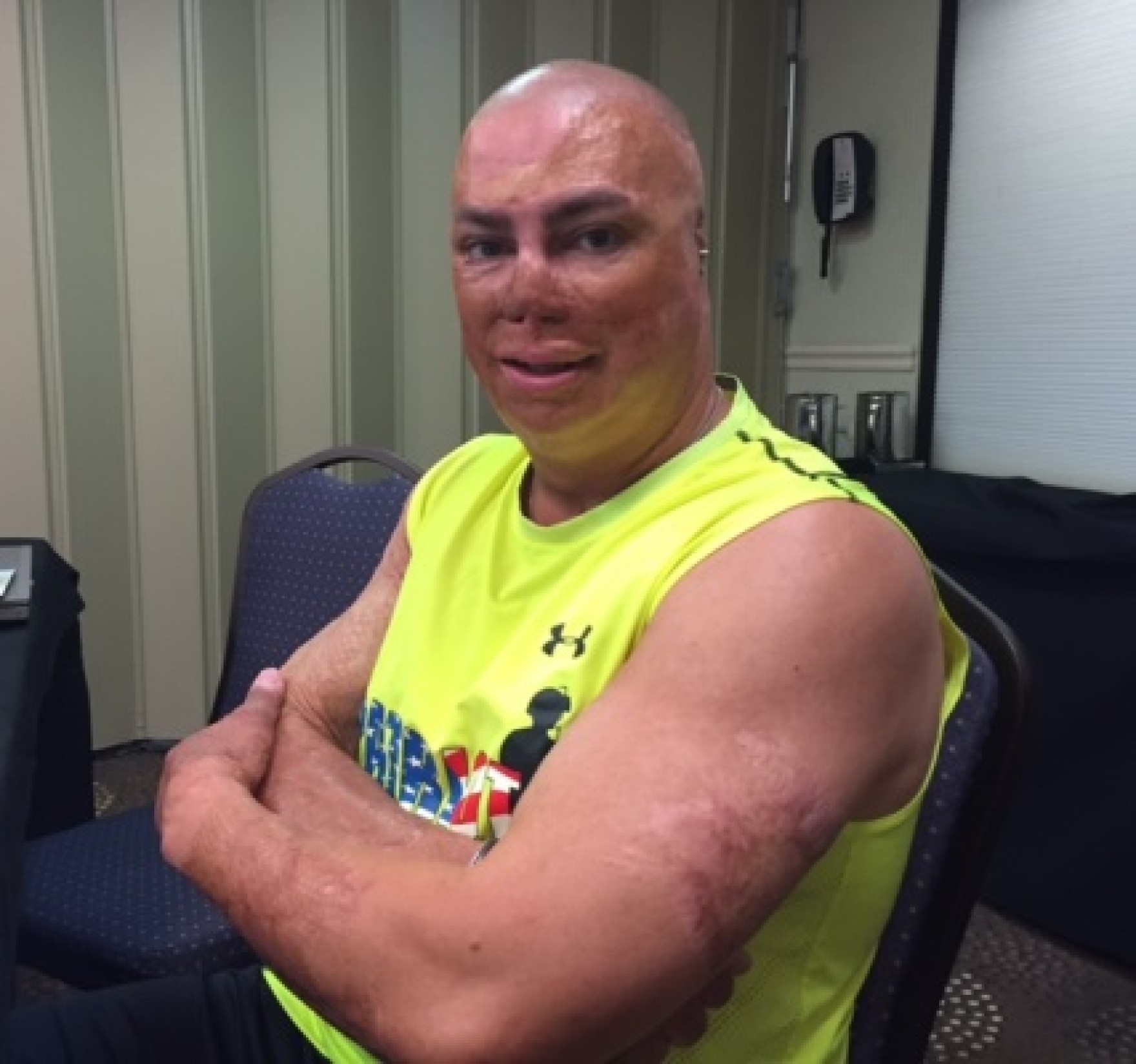 Shilo Harris survived IED on the Metallica Road, endured 60 surgeries ...